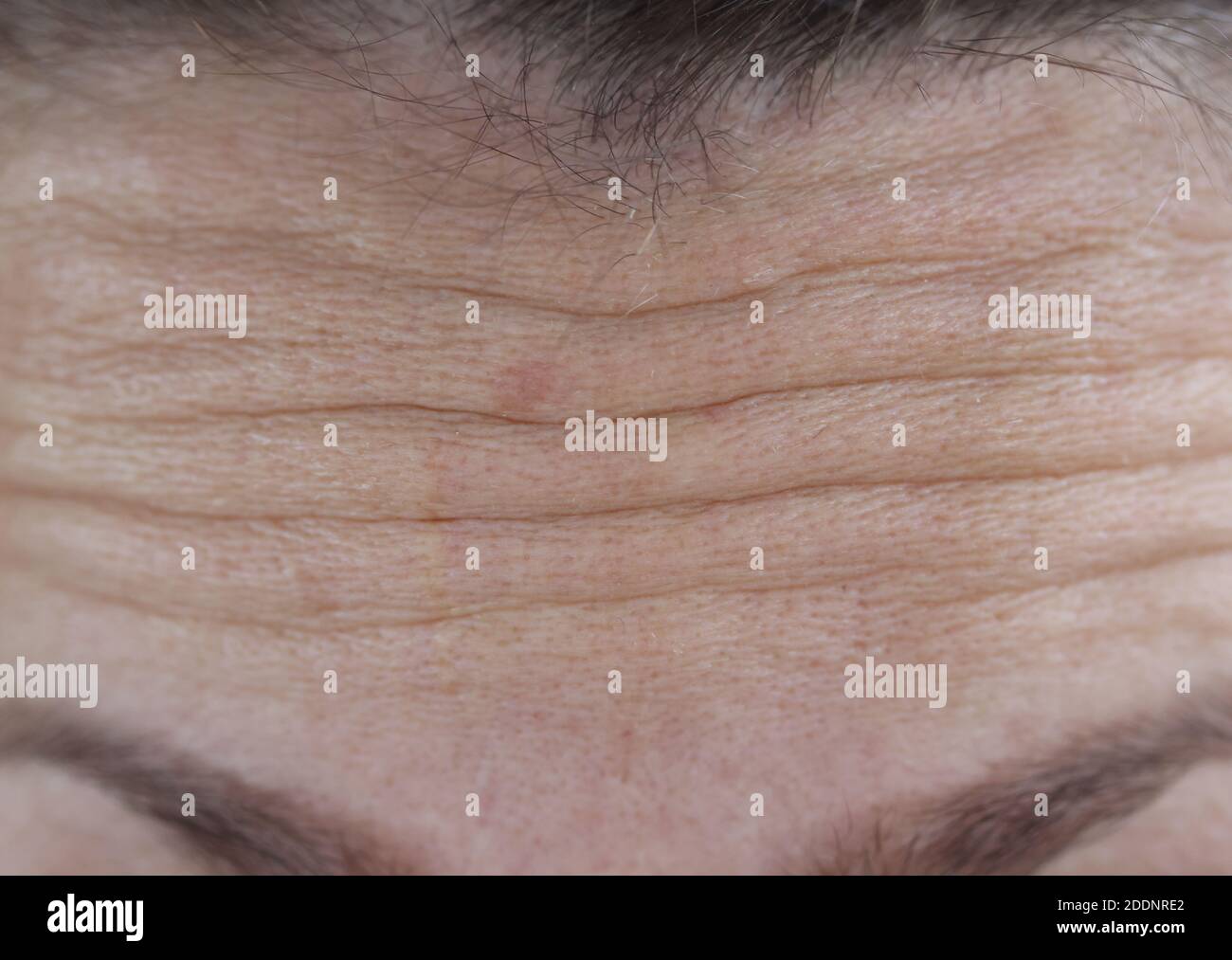 Facial wrinkles on forehead of adult woman closeup Stock Photo - Alamy
