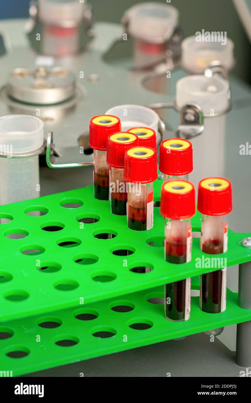 Centrifuge vial hi-res stock photography and images - Alamy