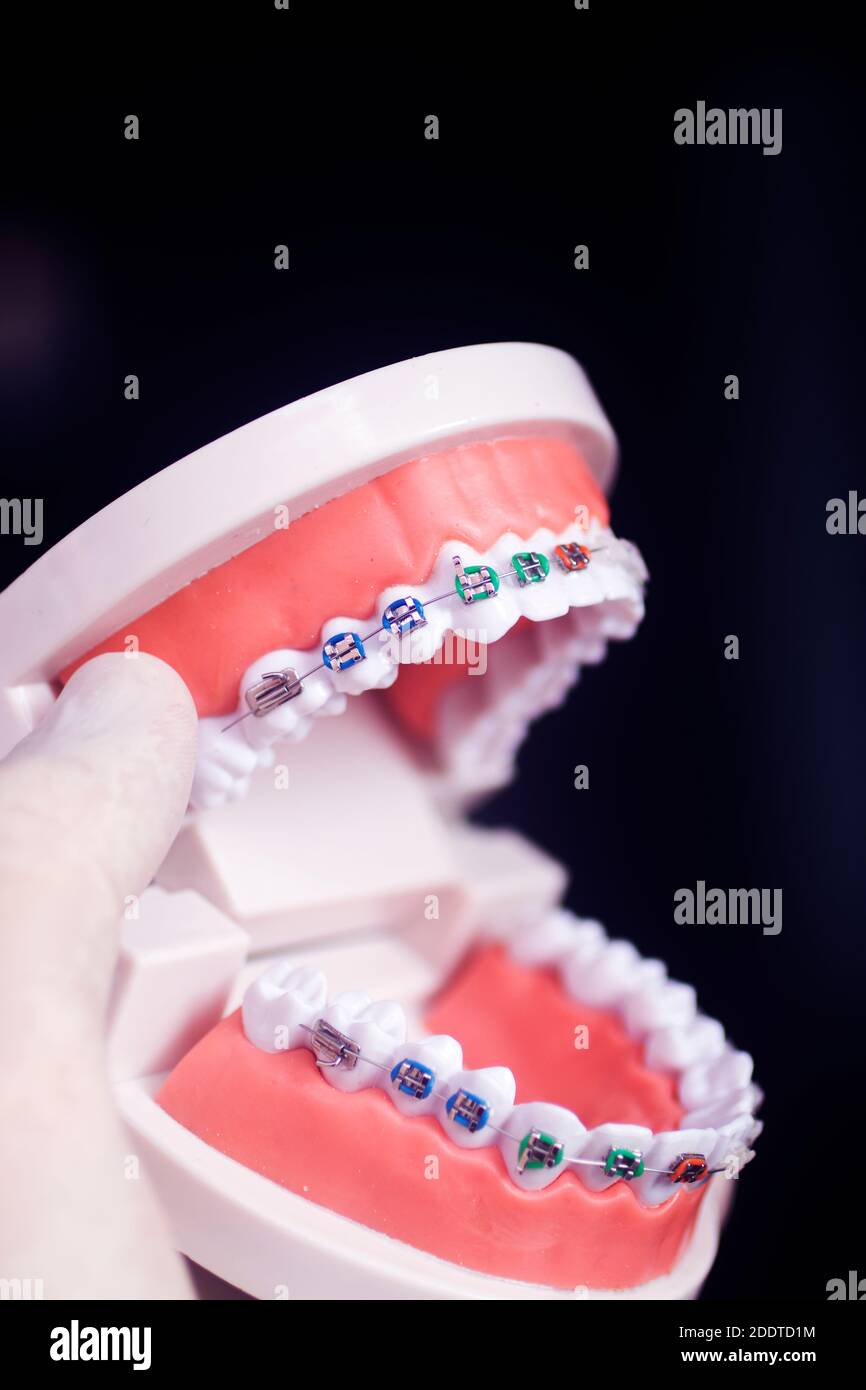 Dental teeth aligner bracket teaching student model showing gums and ...