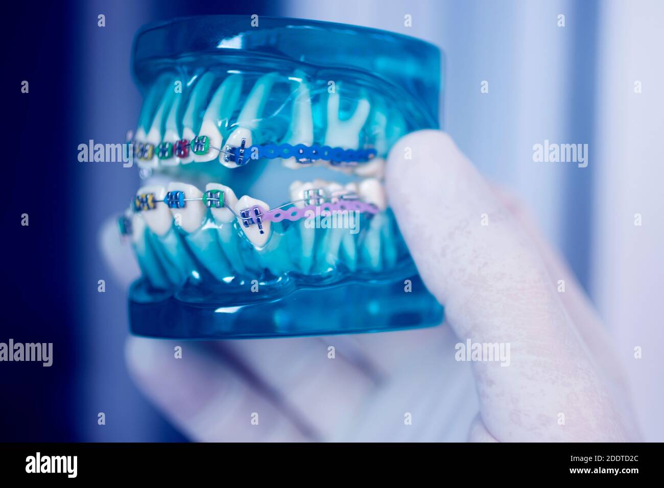 Dental teeth aligner bracket teaching student model showing gums and ...