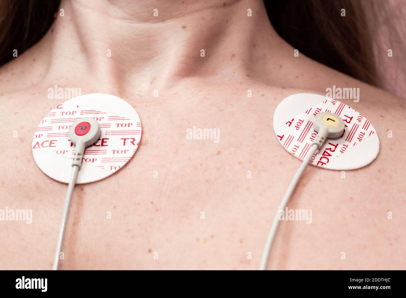 Electrode chest hi-res stock photography and images - Alamy