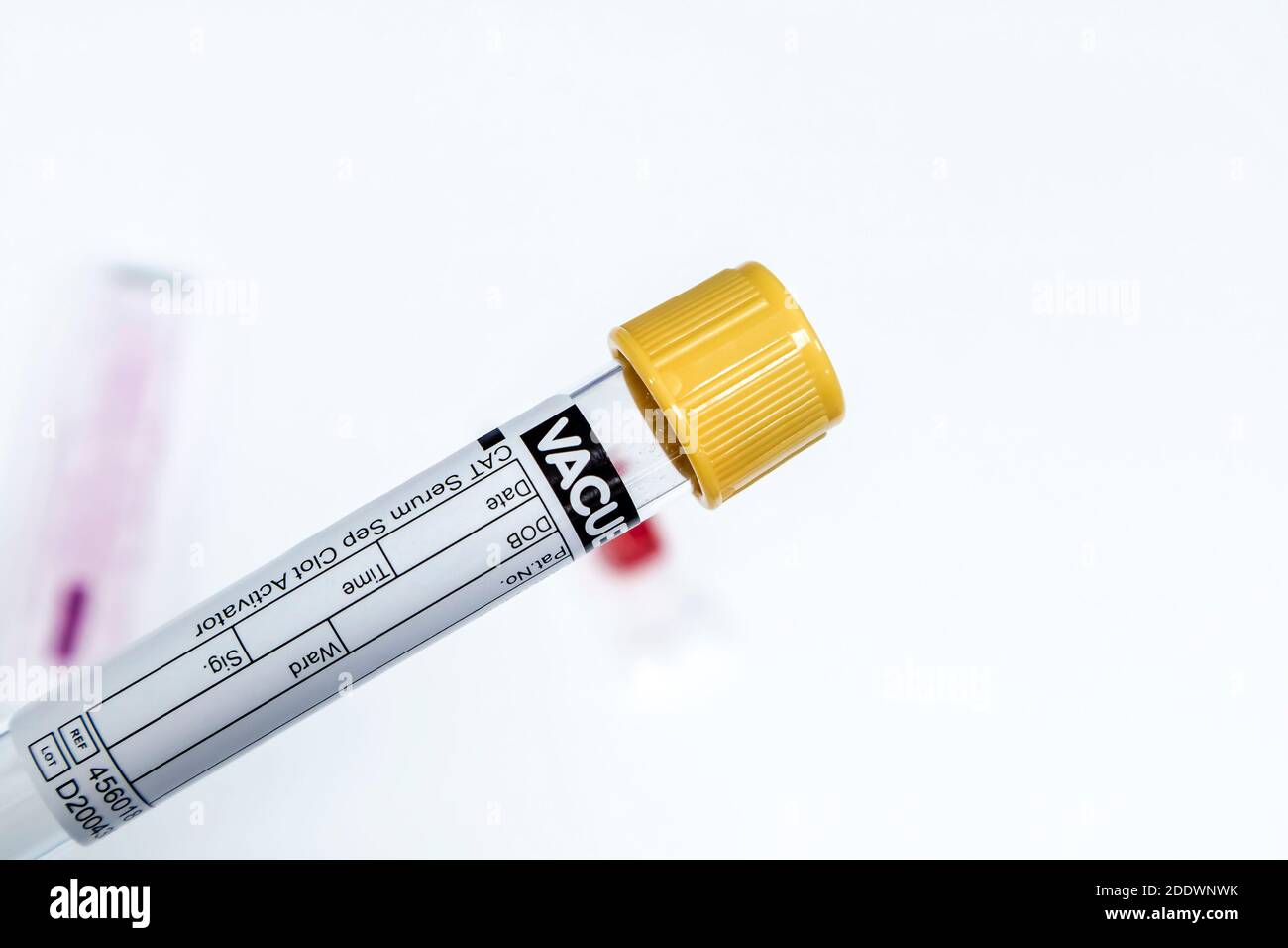 Biochemistryblood sampling hi-res stock photography and images - Alamy