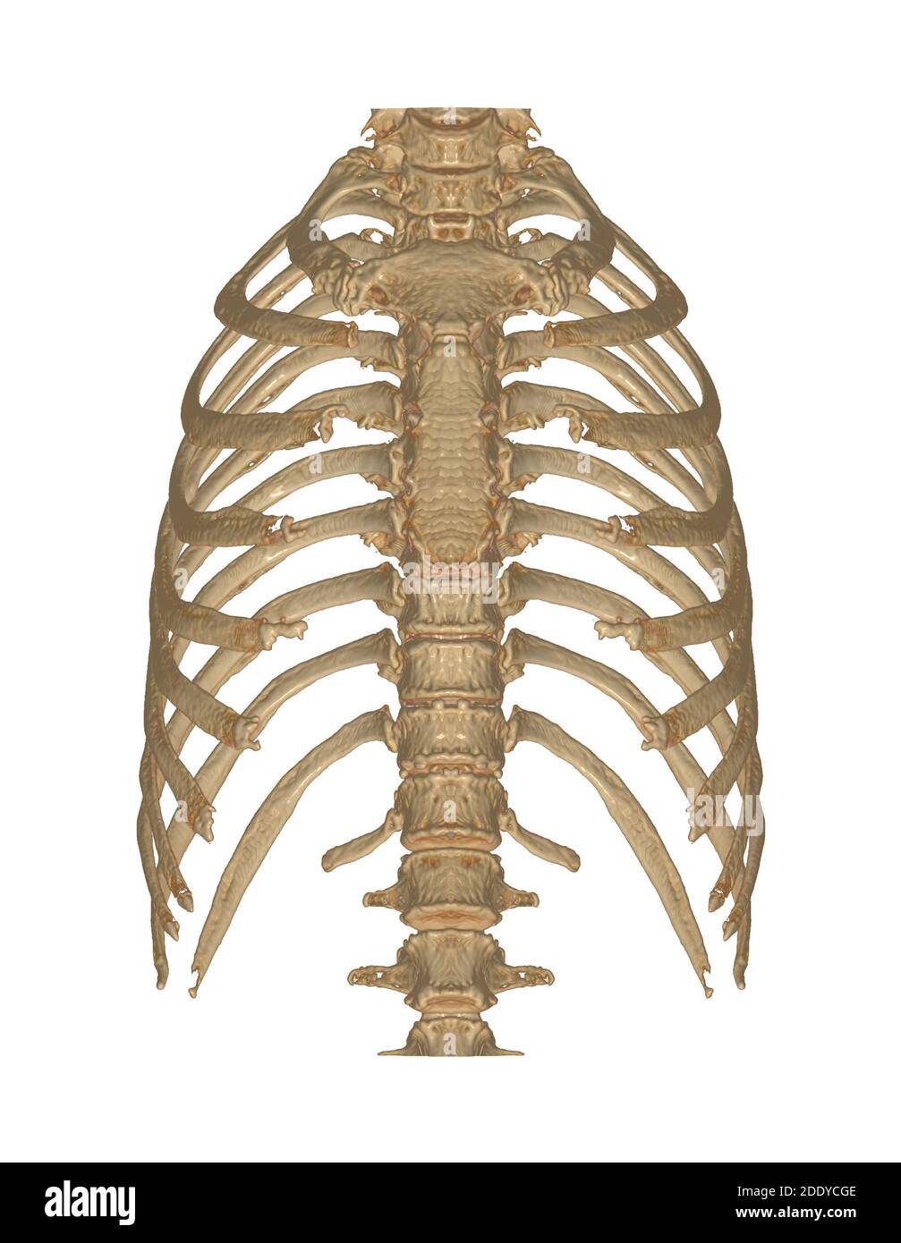 CT Chest or thorax with 3D rendering of lung and Rib on monitor ...
