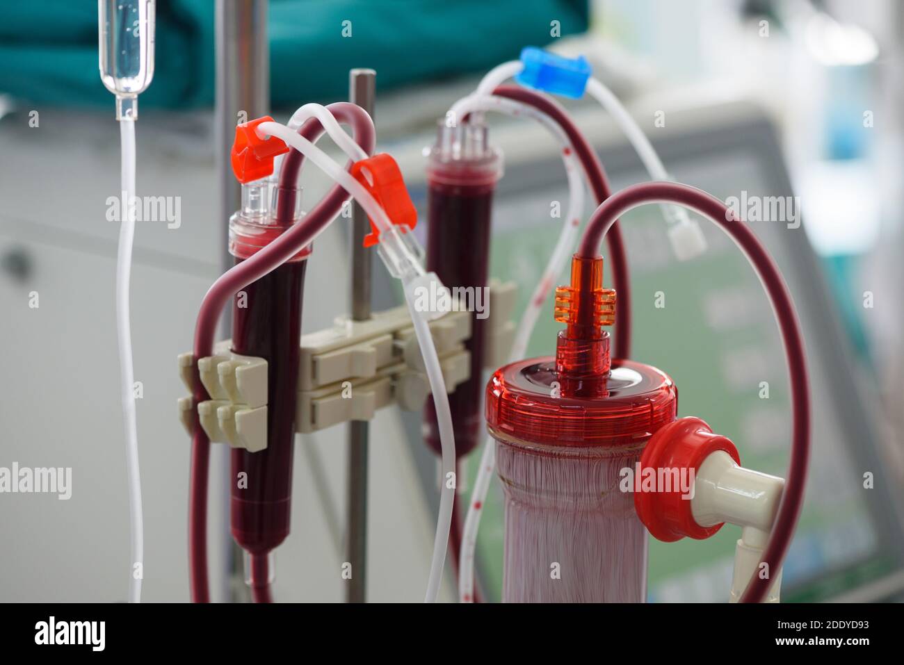 Kidney failure hi-res stock photography and images - Alamy