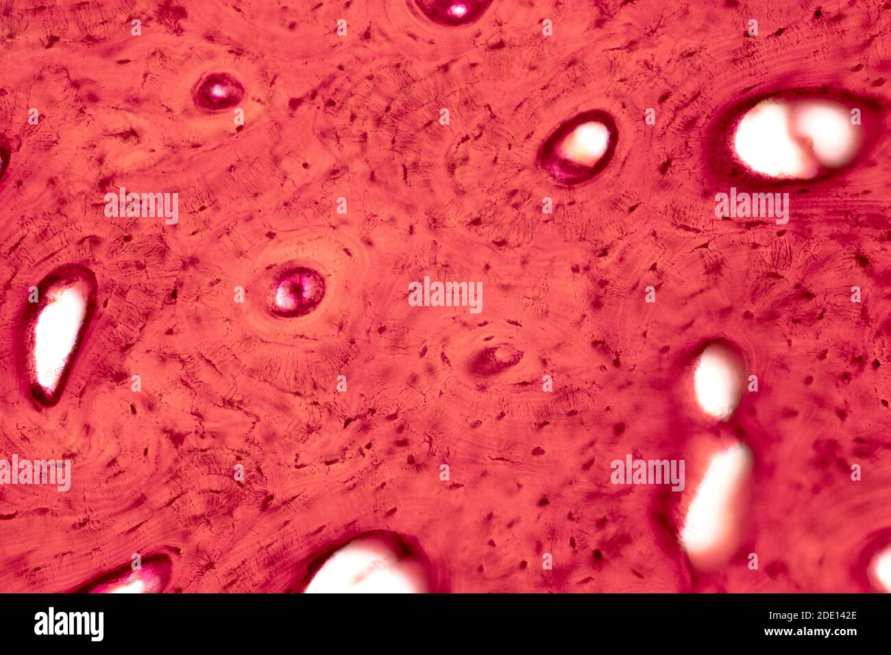 Compact bone micrograph hi-res stock photography and images - Alamy