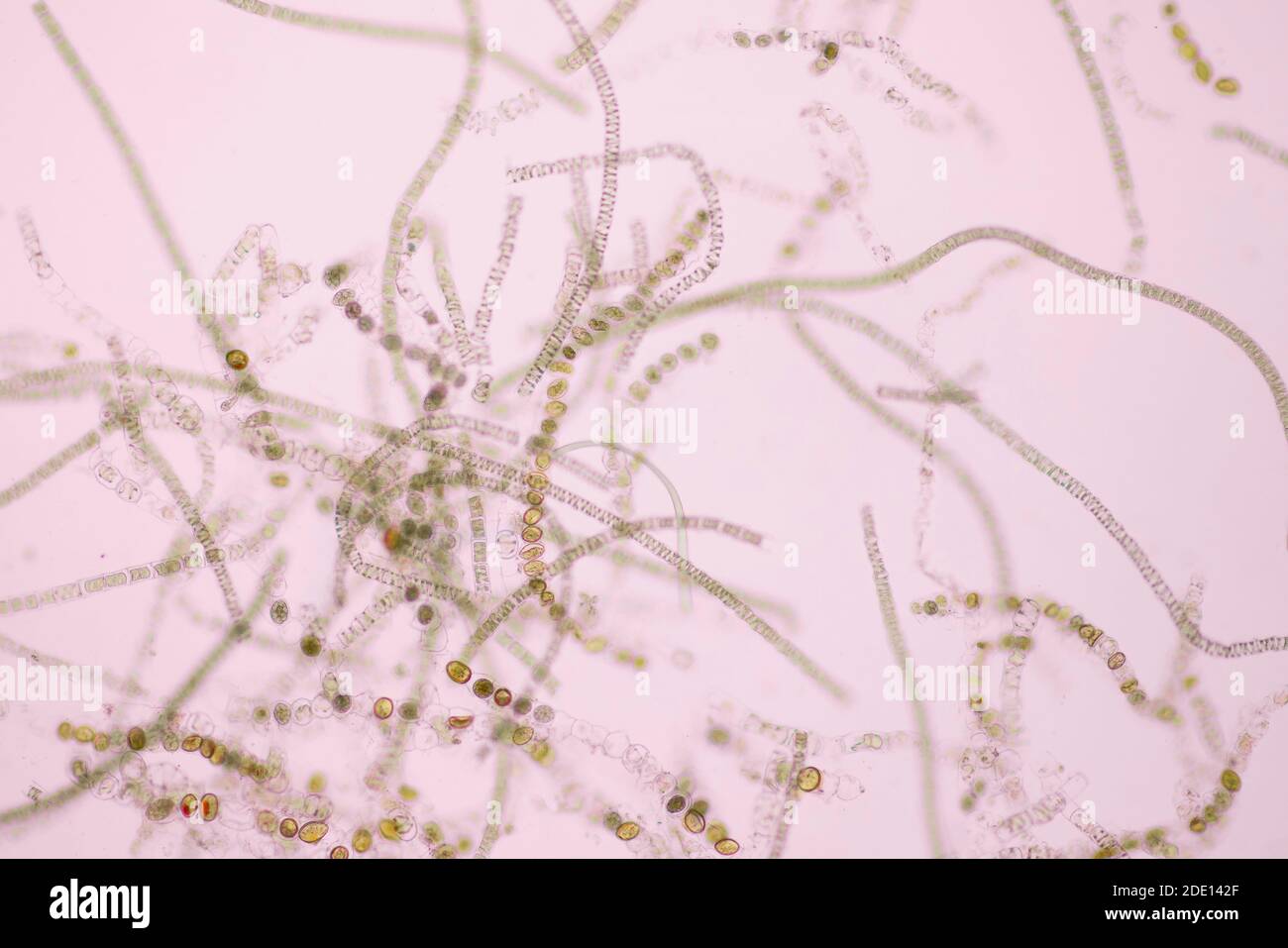 Filamentous algae, light micrograph Stock Photo - Alamy