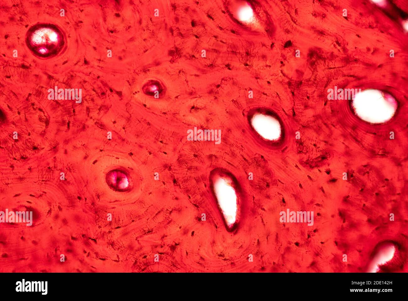Human compact bone tissue, light micrograph Stock Photo - Alamy