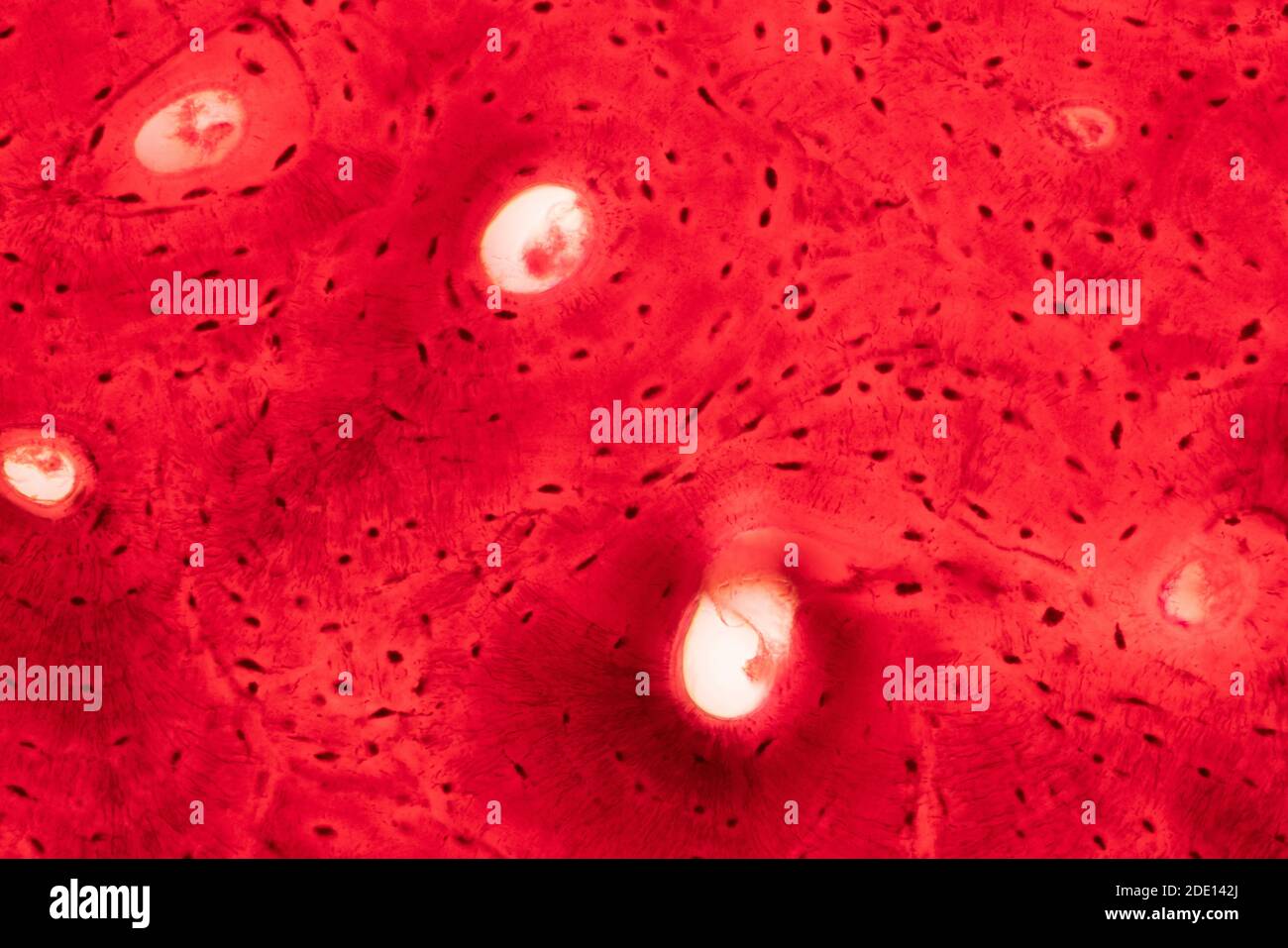 Compact bone tissue hi-res stock photography and images - Alamy