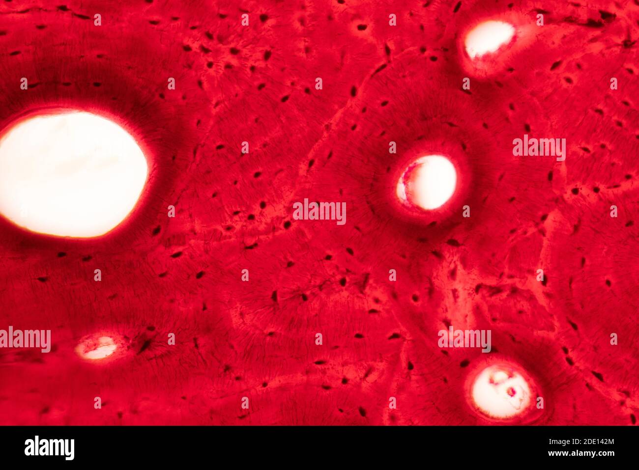 Normal bone, micrograph hi-res stock photography and images - Alamy