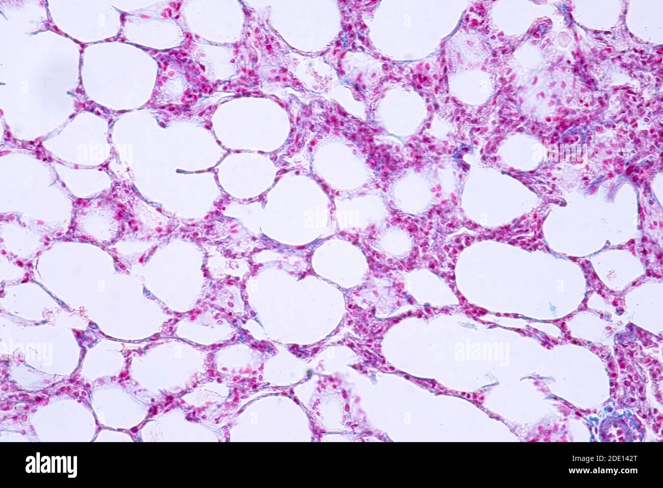 Normal Human Lung Histology