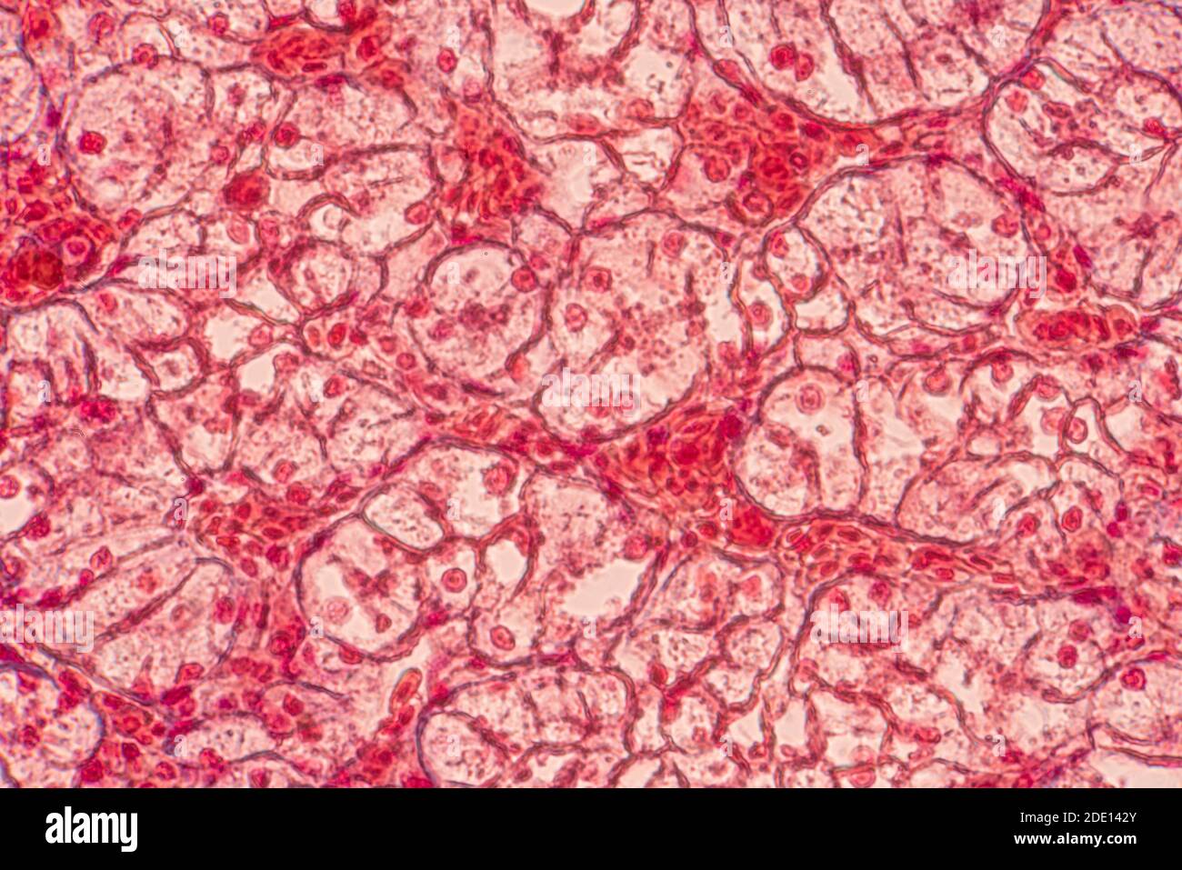 Squamous epithelial cells, light micrograph Stock Photo - Alamy