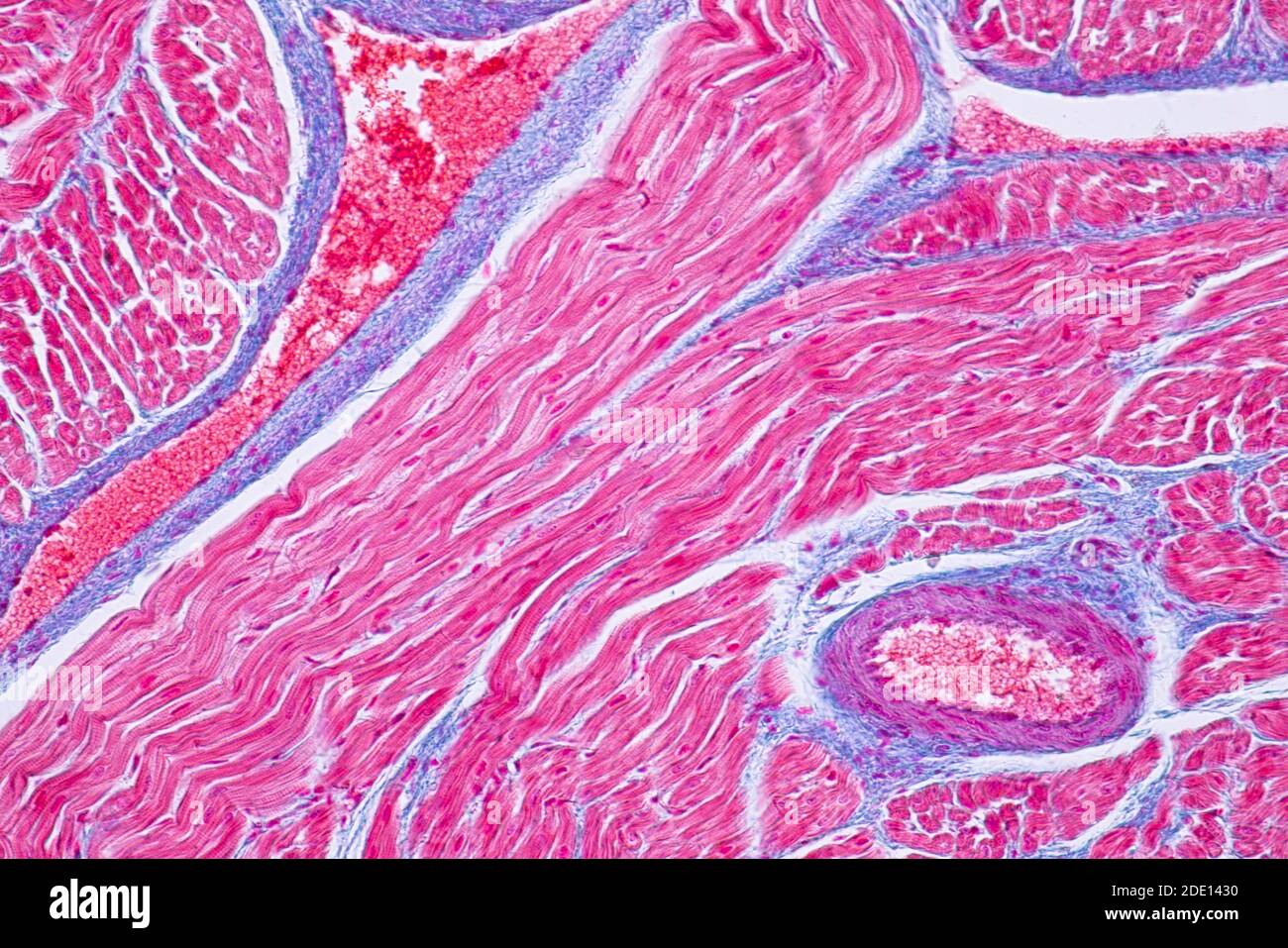 Human cardiac muscle, light micrograph Stock Photo - Alamy