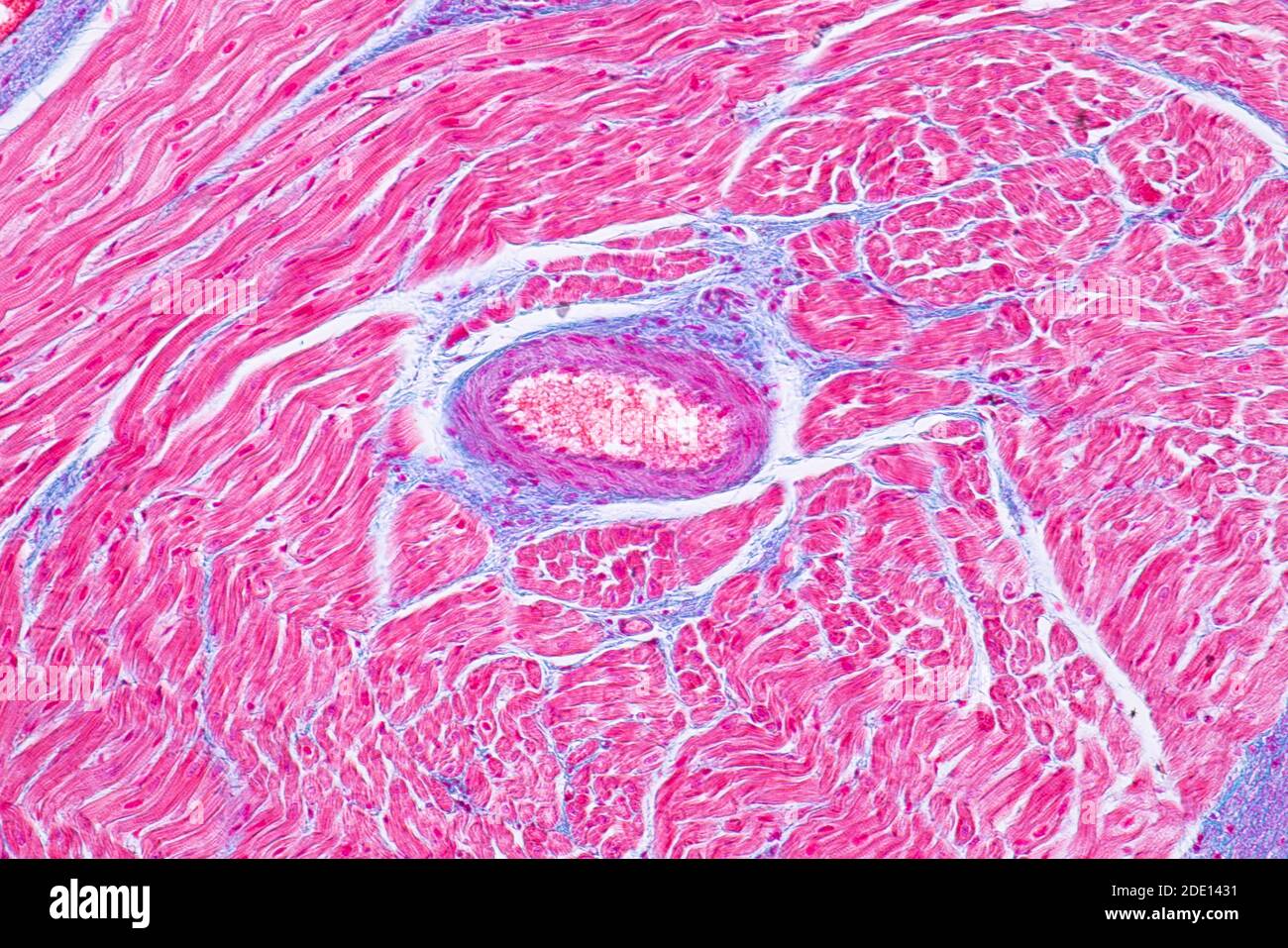 Human cardiac muscle, light micrograph Stock Photo - Alamy
