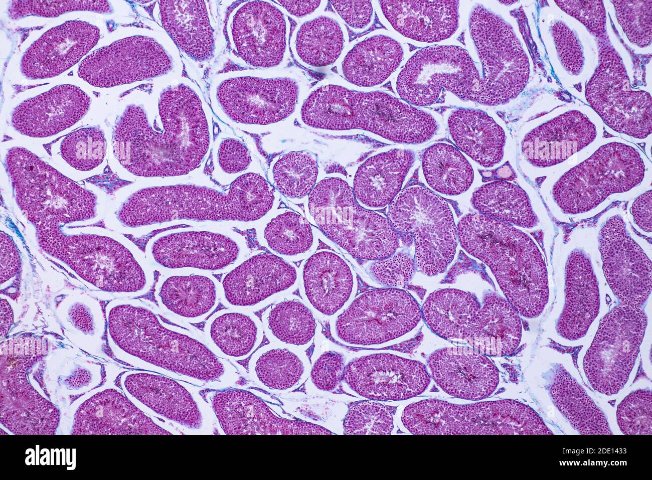 Human testis, light micrograph Stock Photo - Alamy