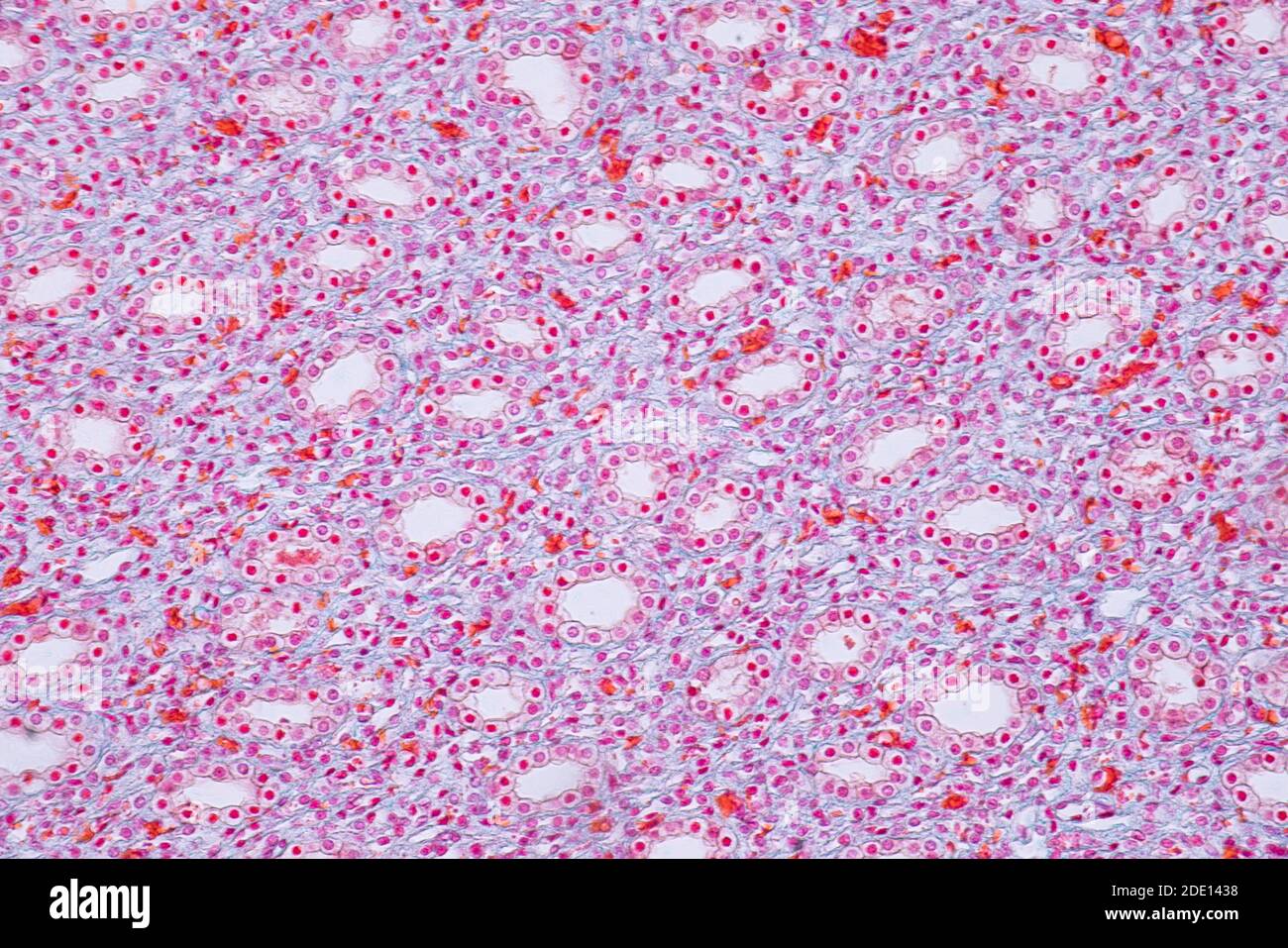 Human kidney, light micrograph Stock Photo - Alamy