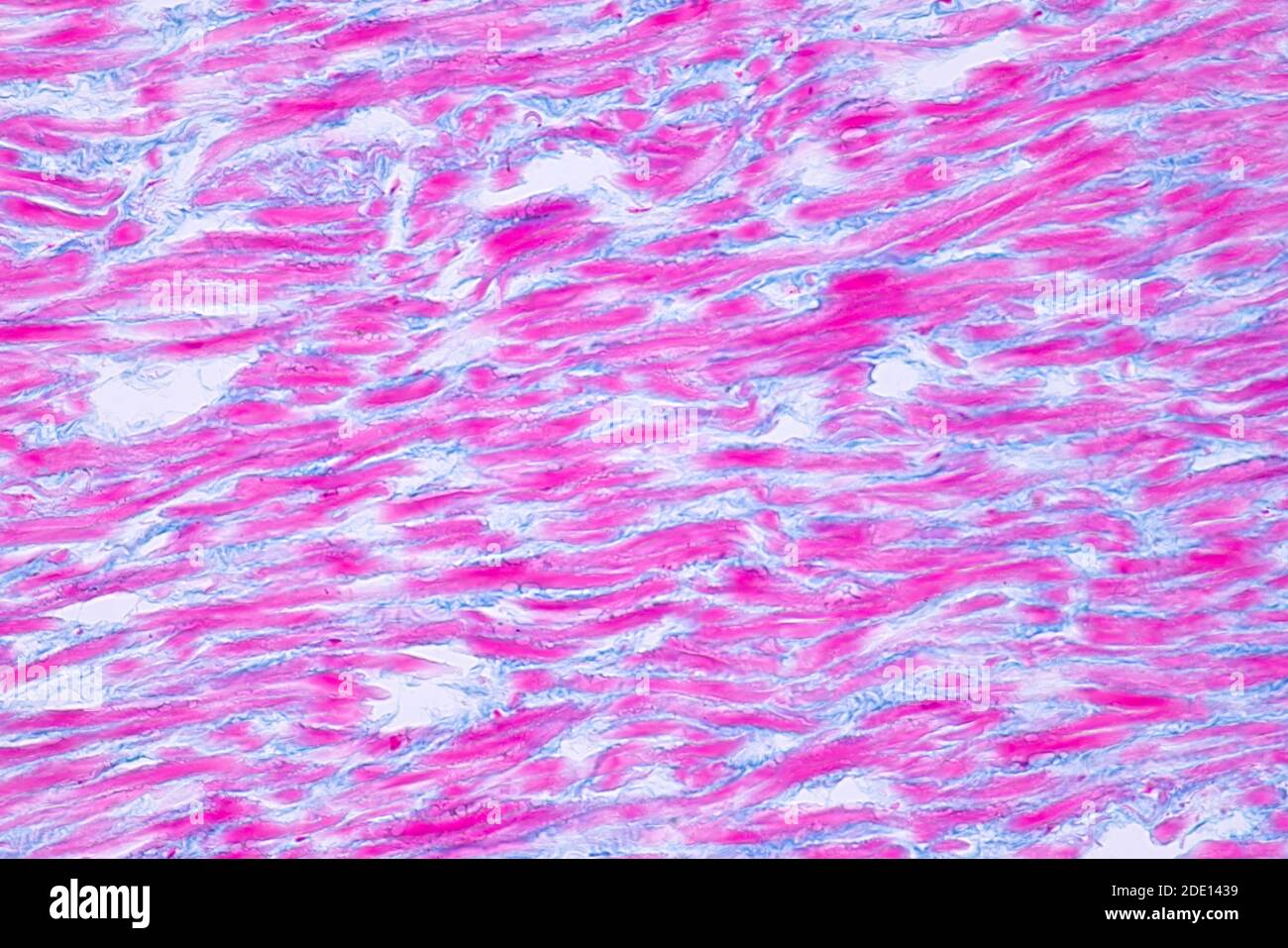 Human cardiac muscle, light micrograph Stock Photo - Alamy