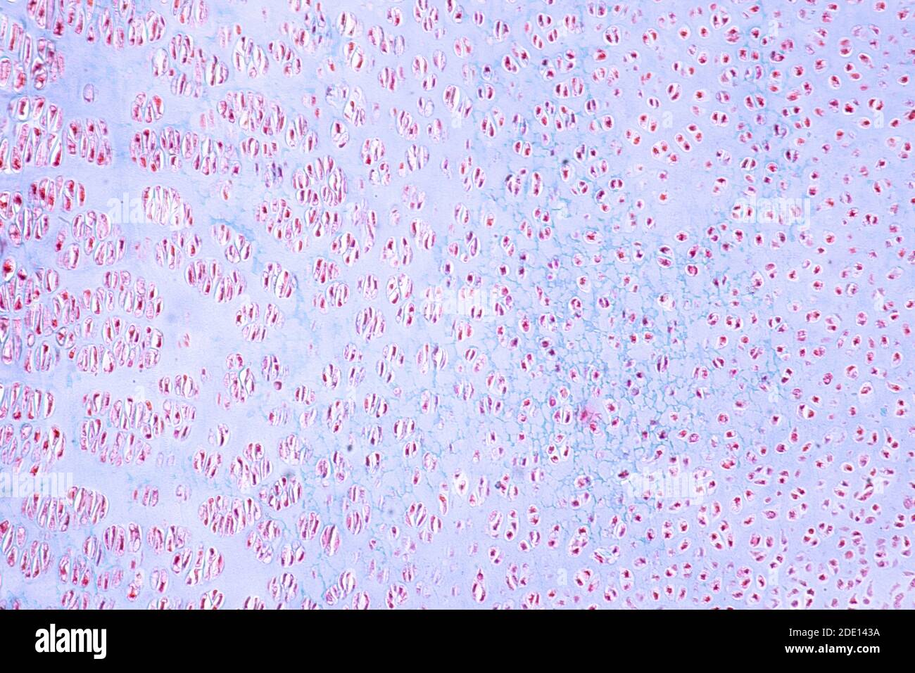 Human cartilage and bone, light micrograph Stock Photo - Alamy