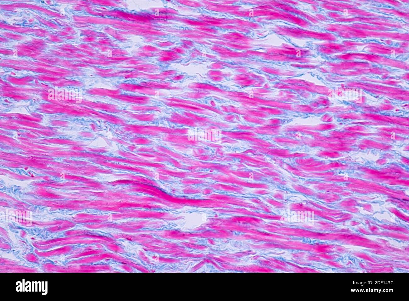 Human cardiac muscle, light micrograph Stock Photo - Alamy