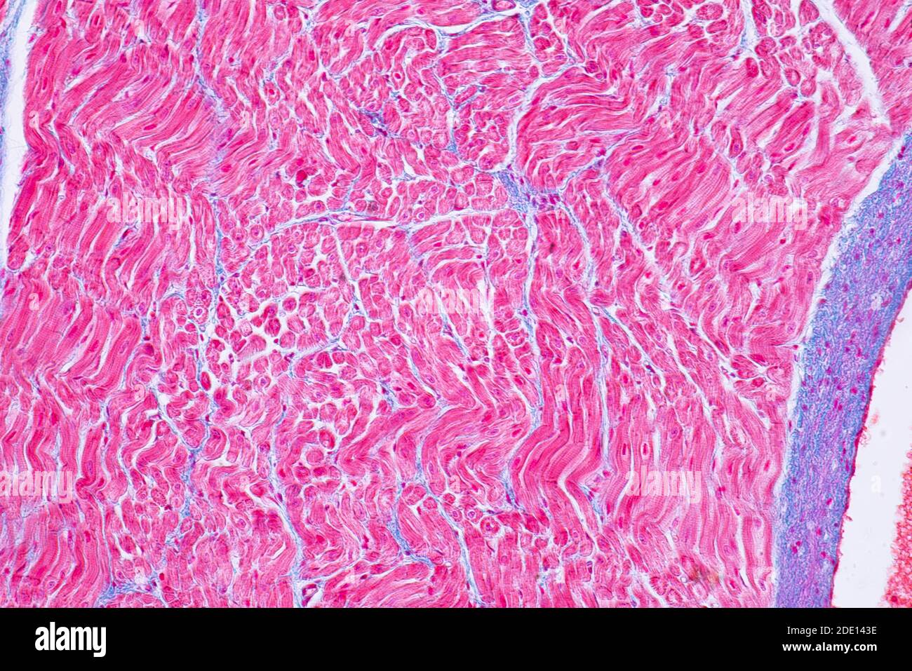 Human cardiac muscle, light micrograph Stock Photo - Alamy