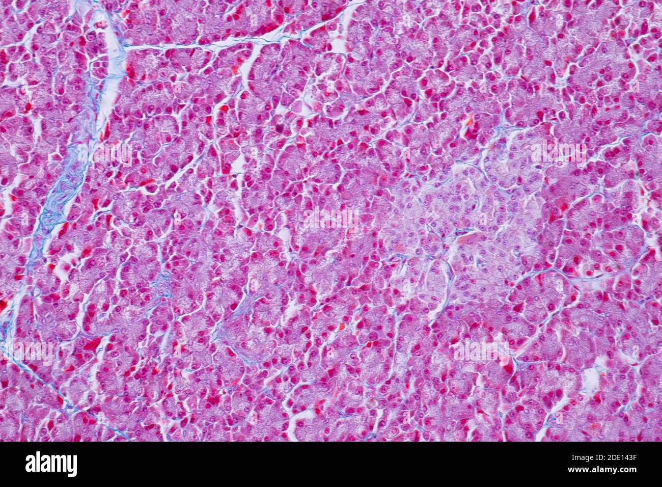 Human liver tissue, light micrograph Stock Photo - Alamy