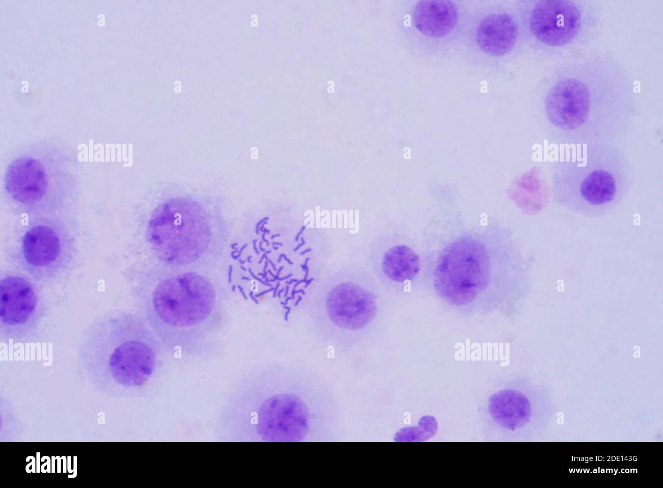 Human cells mitosis microscope hi-res stock photography and images - Alamy