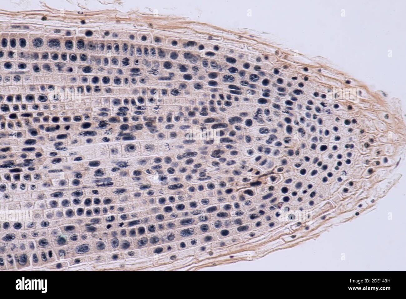 Mitosis, light micrograph Stock Photo - Alamy