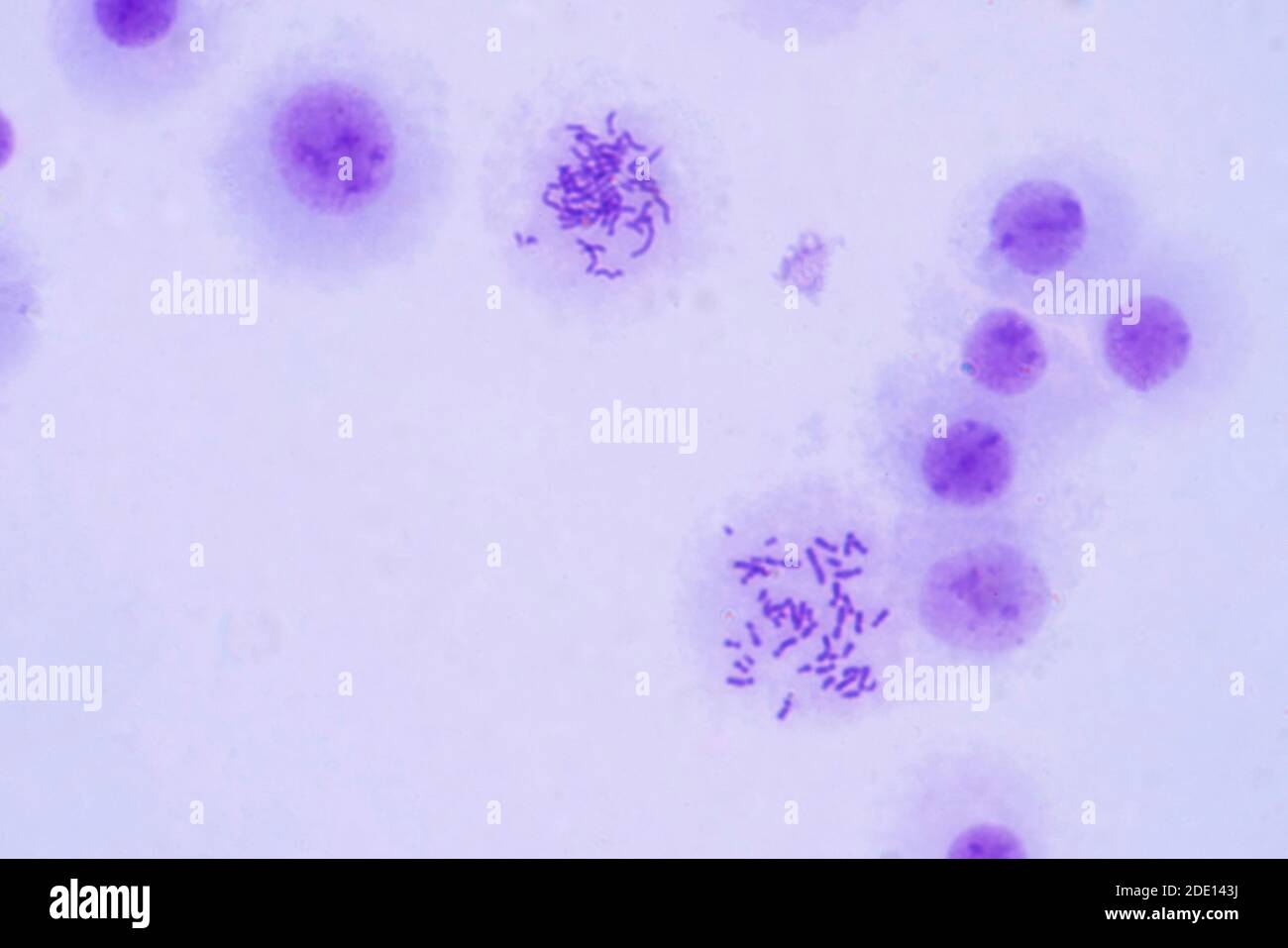 Mitosis, light micrograph Stock Photo - Alamy