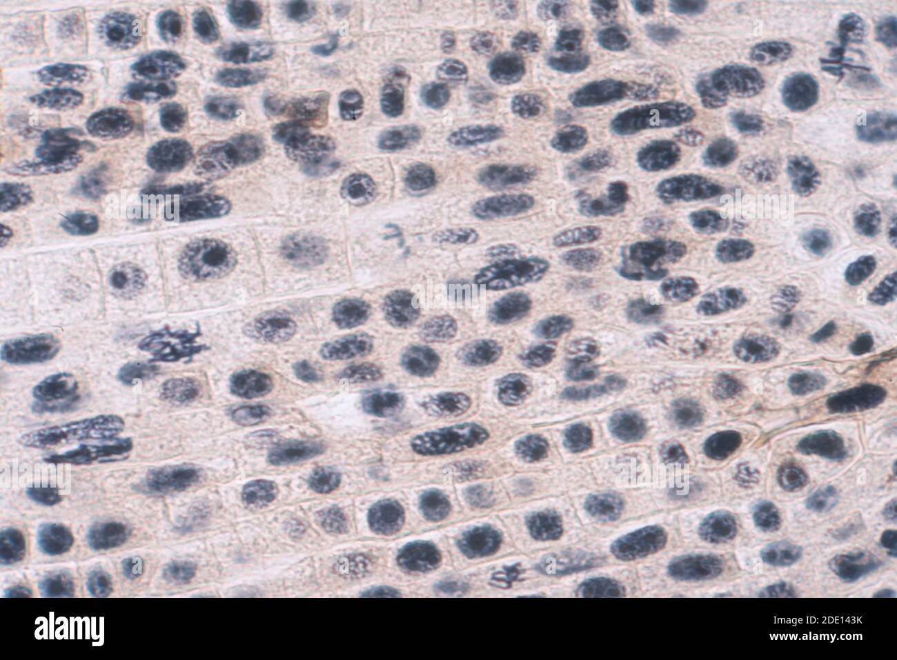 Mitosis, light micrograph Stock Photo - Alamy