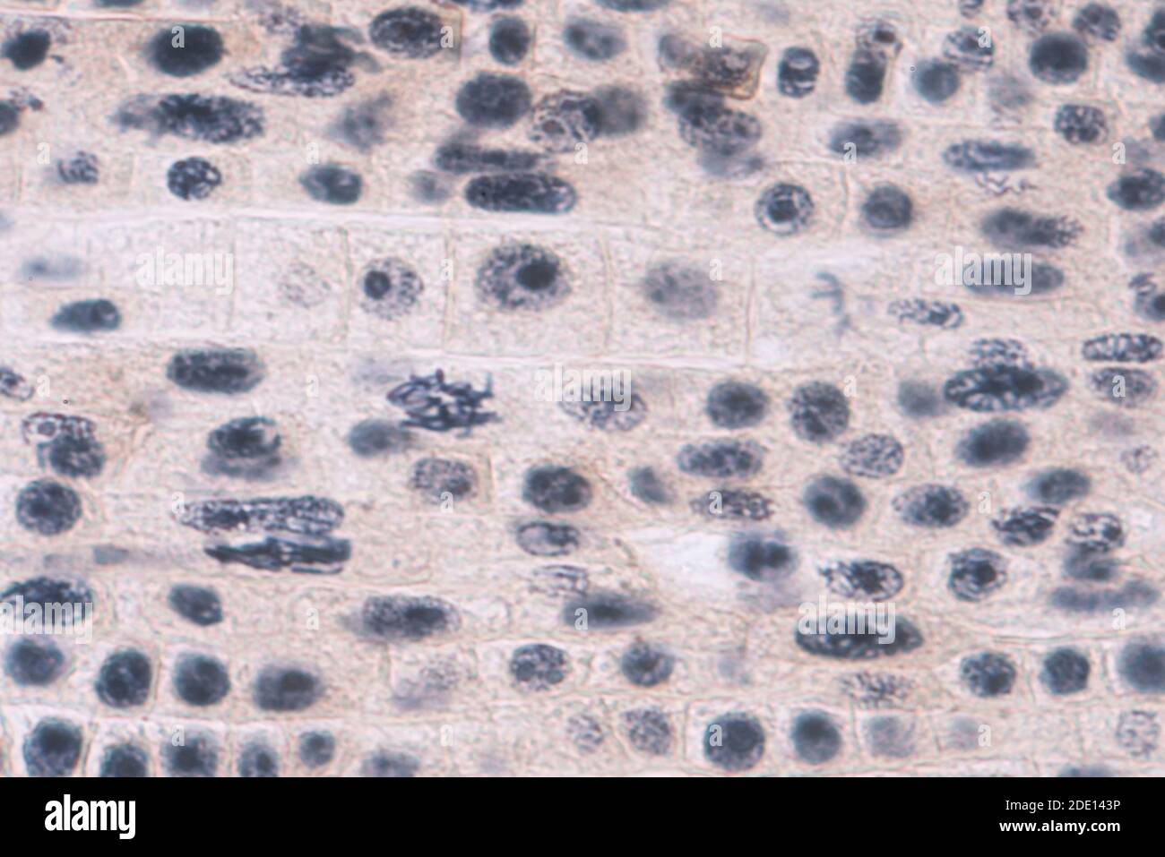 Mitosis, light micrograph Stock Photo - Alamy