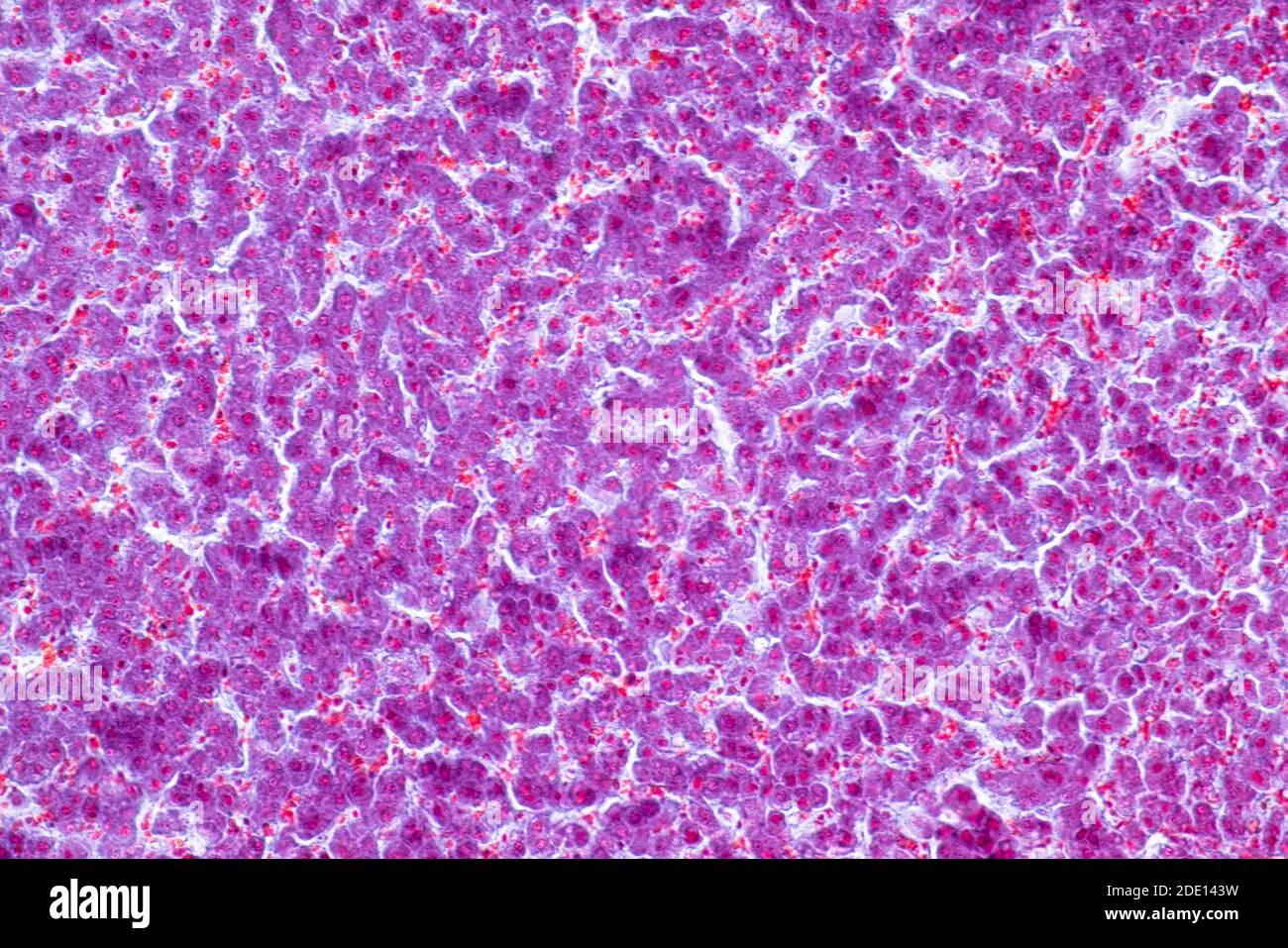 Human liver tissue, light micrograph Stock Photo - Alamy