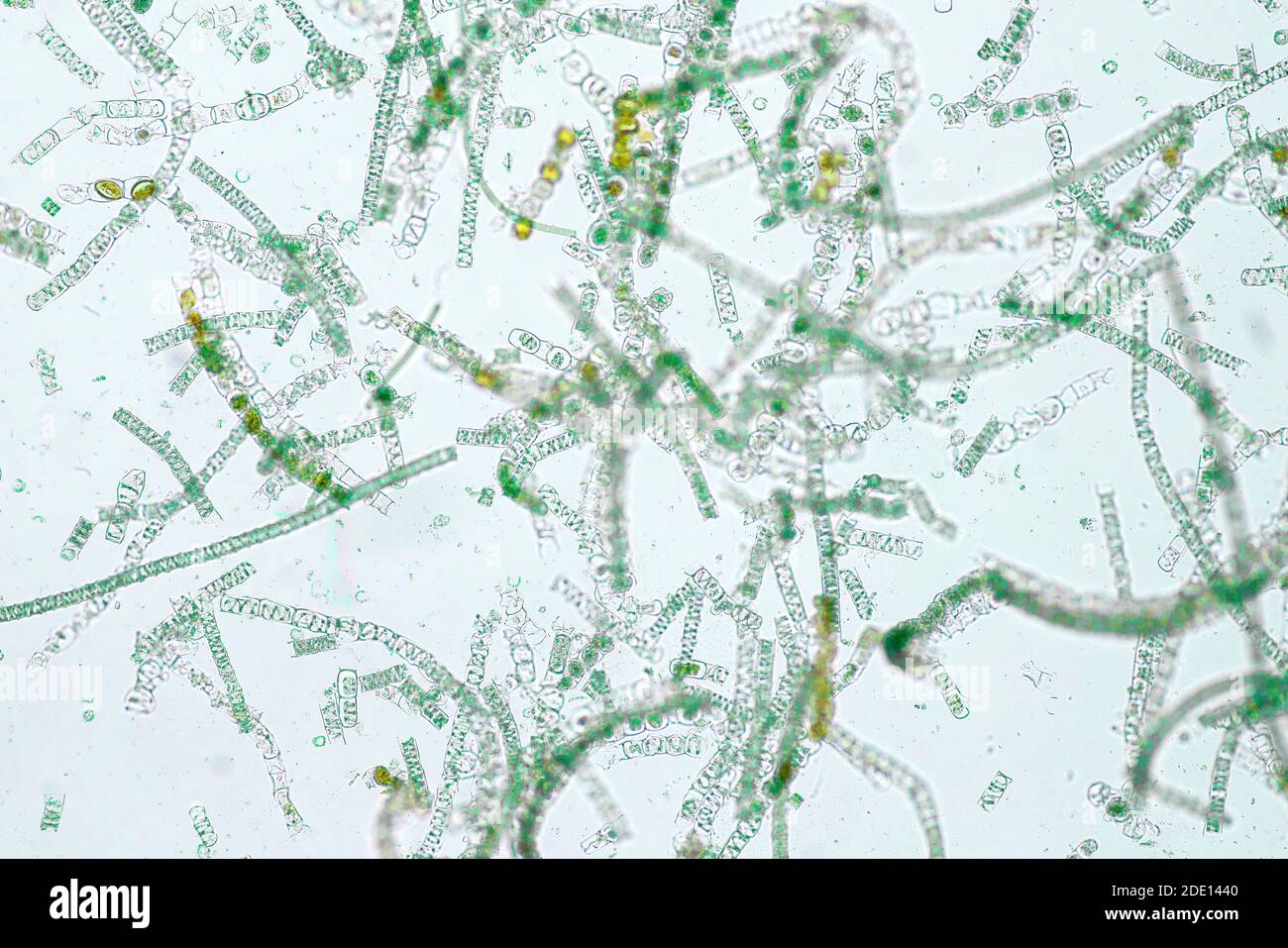 Filamentous algae, light micrograph Stock Photo - Alamy