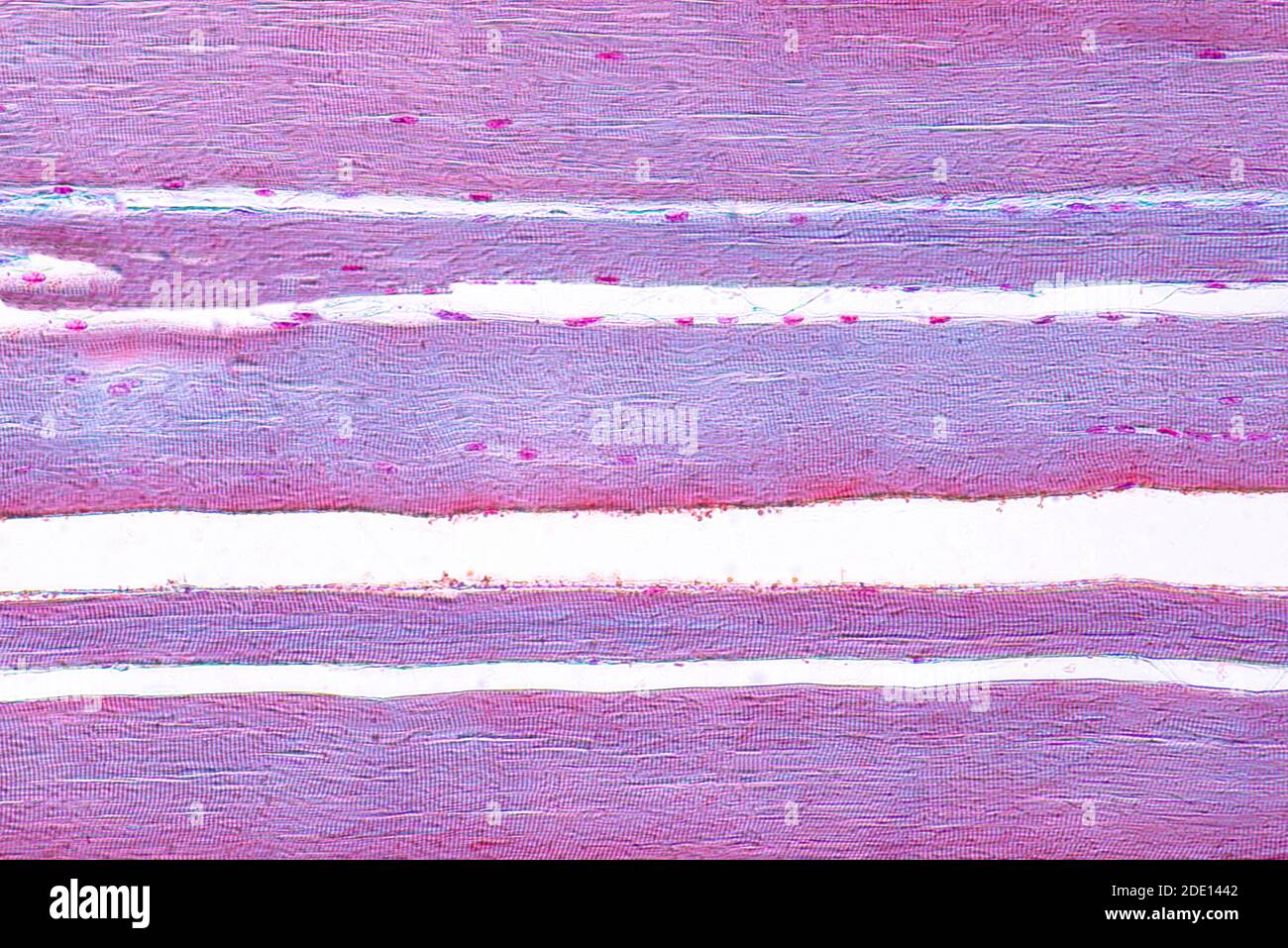 Human skeletal muscle, light micrograph Stock Photo - Alamy Human skeletal muscle, light micrograph Stock Photo - Alamy