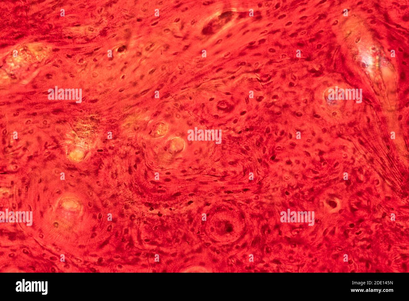 Human compact bone tissue, light micrograph Stock Photo - Alamy