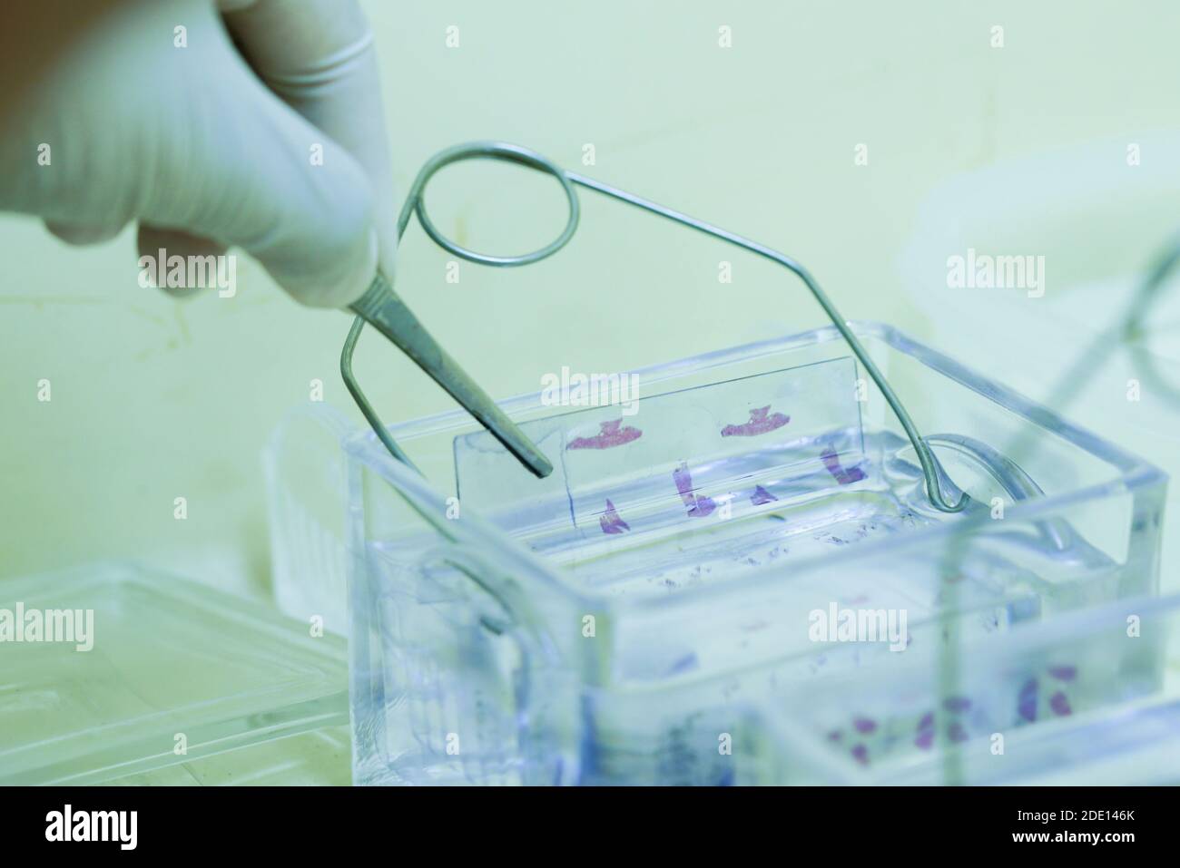 Pathology hi-res stock photography and images - Alamy