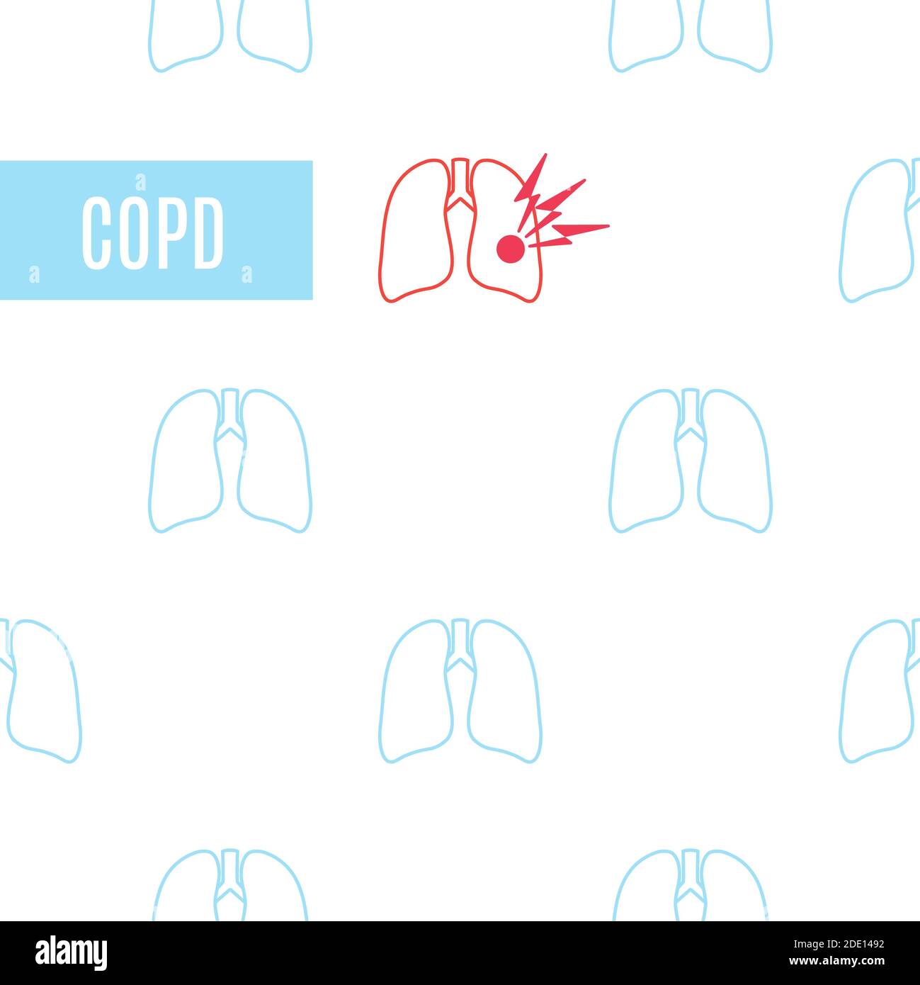 Chronic obstructive pulmonary disease, illustration Stock Photo - Alamy