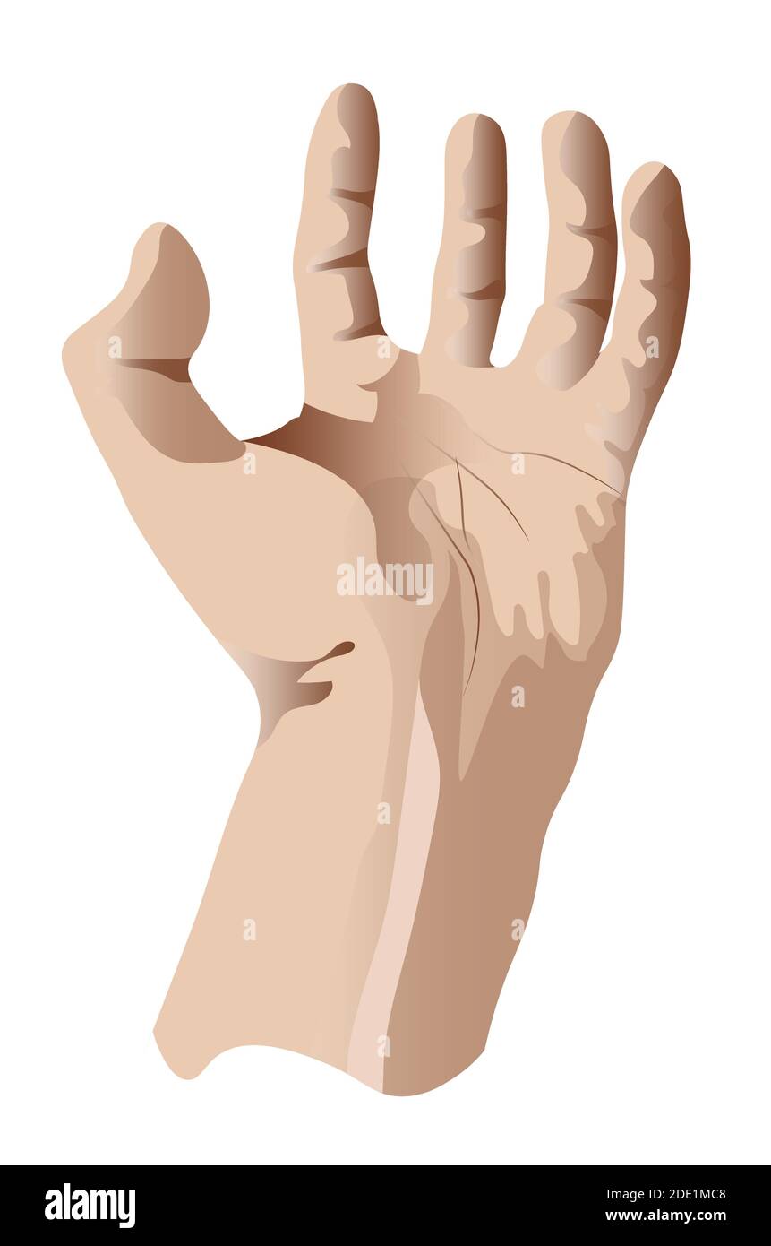 Left Hand Open Drawing