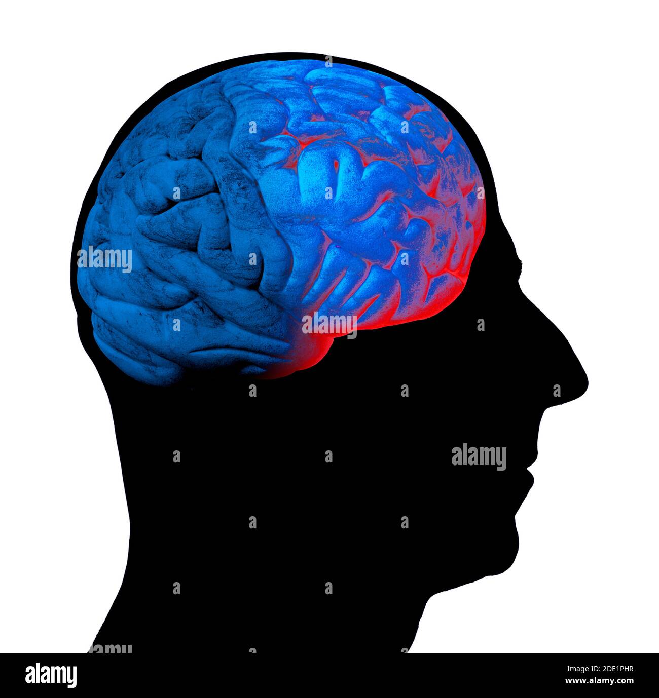 Brain in head Stock Photo - Alamy