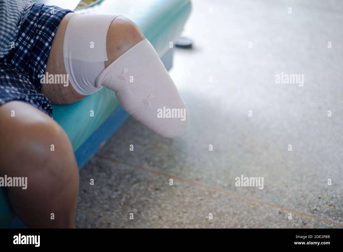 Below knee amputation stump hi-res stock photography and images - Alamy