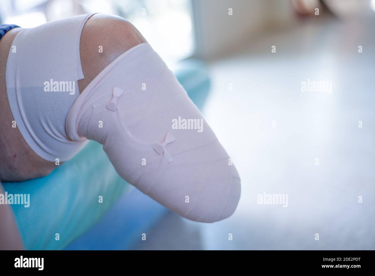 Below knee amputation stump hi-res stock photography and images - Alamy