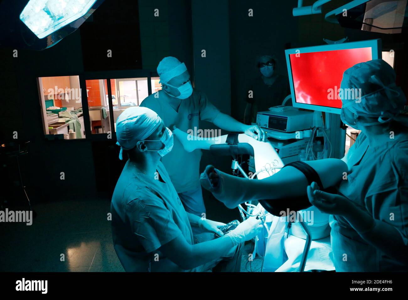Operating room, gynaecological surgery, laparoscopy, Karlovy Vary ...