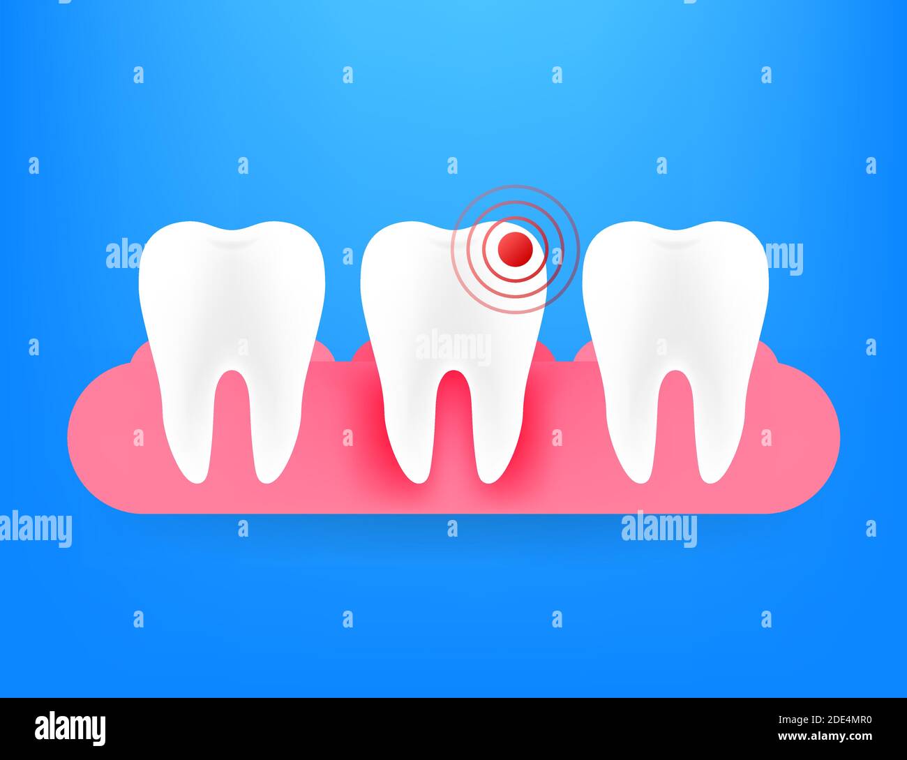 Toothache icon, bad tooth. Vector stock illustration Stock Vector Image ...