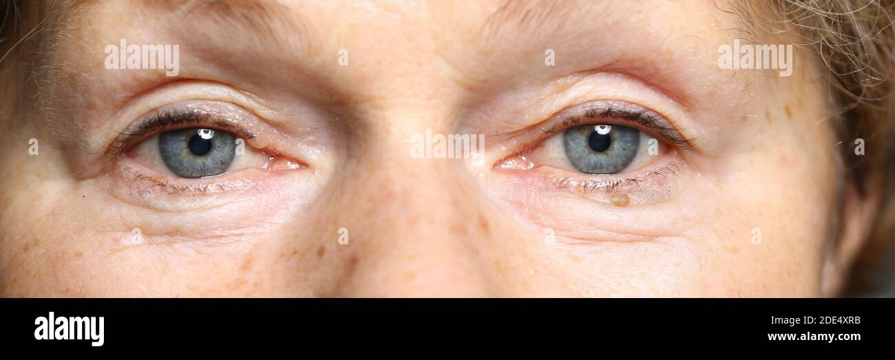 Tired look hi-res stock photography and images - Alamy