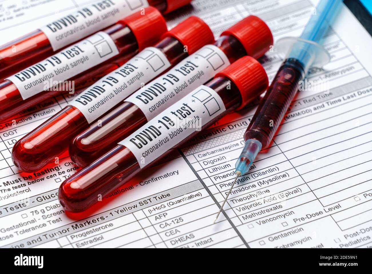 Clipboard with paper blank form with blood test tubes on blue ...