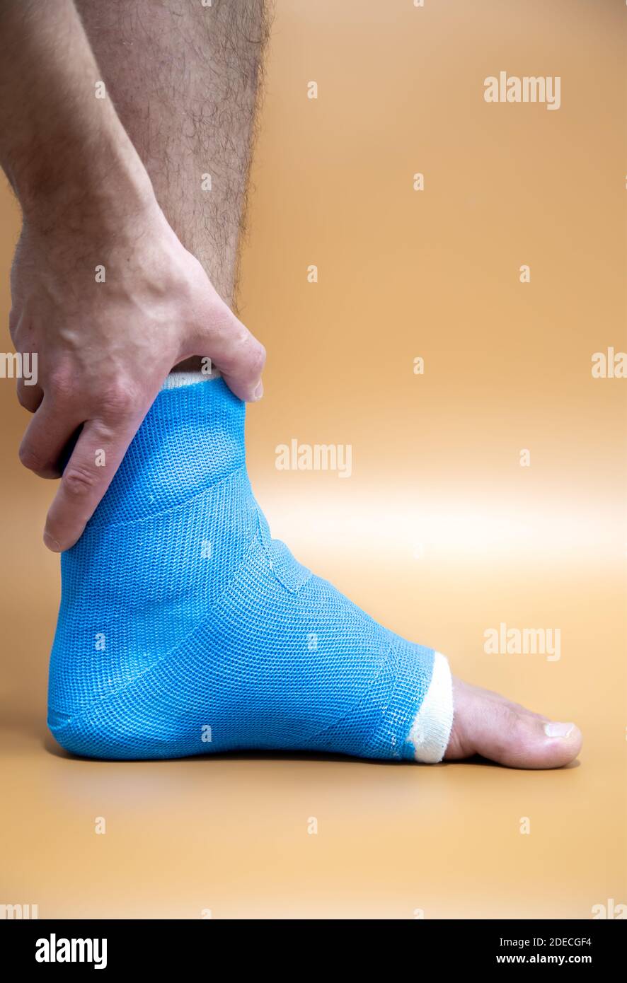Blue splint ankle. Bandaged leg cast on male patient on colored blurred ...