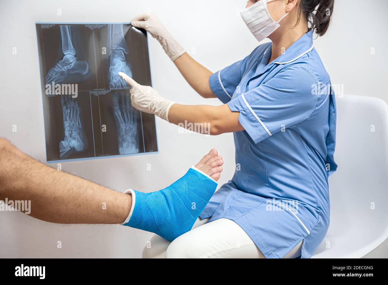 Female doctor in a blue medical gown checking broken leg and shows the ...