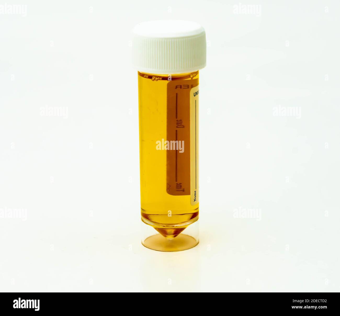 Urine sample in a plastic specimen container, isolated on a white ...