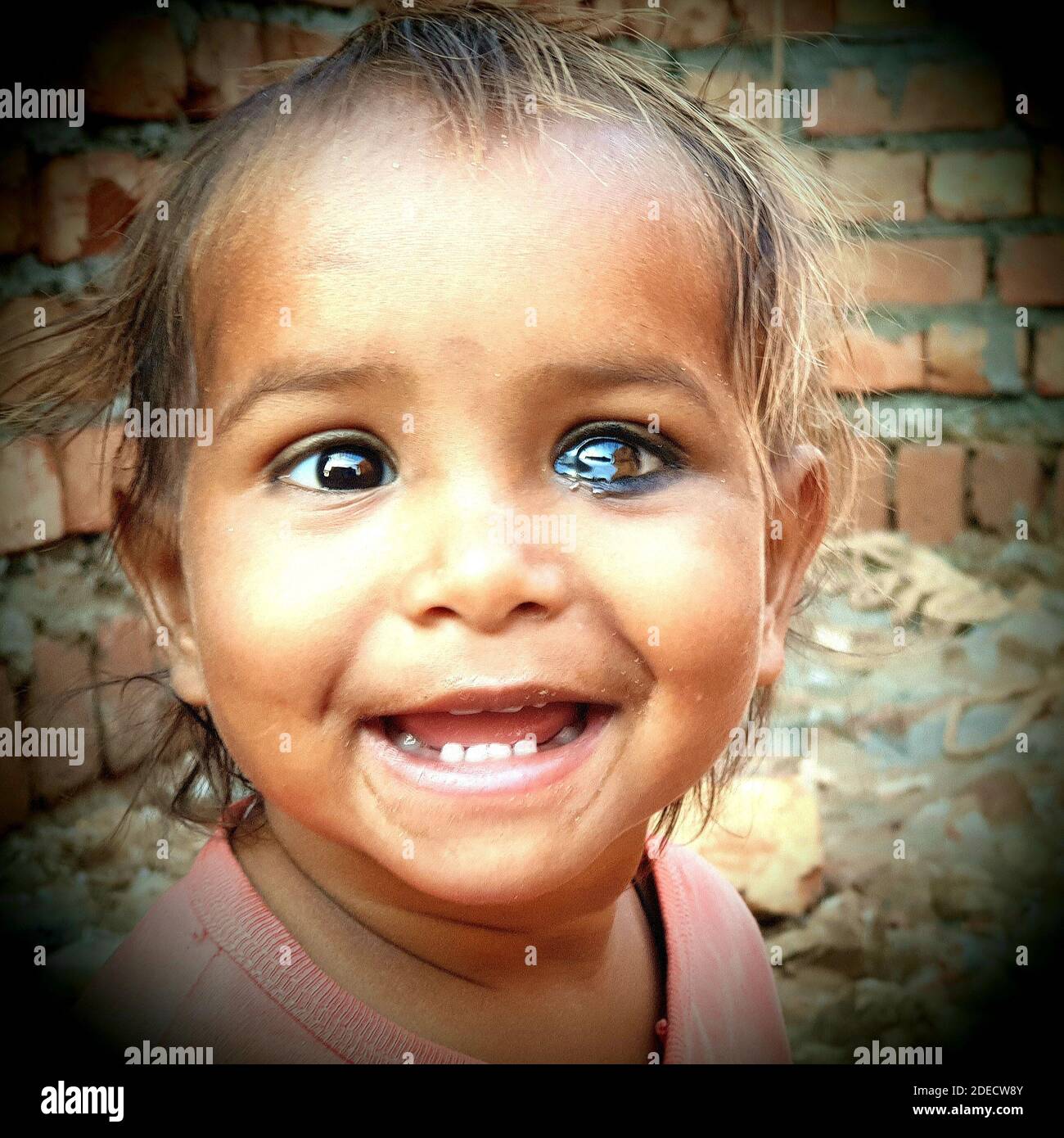 15 march 2020 Jammu District. A child looking on frame left eye is ...