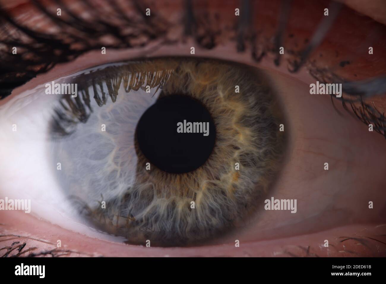 Healthy cornea hi-res stock photography and images - Alamy