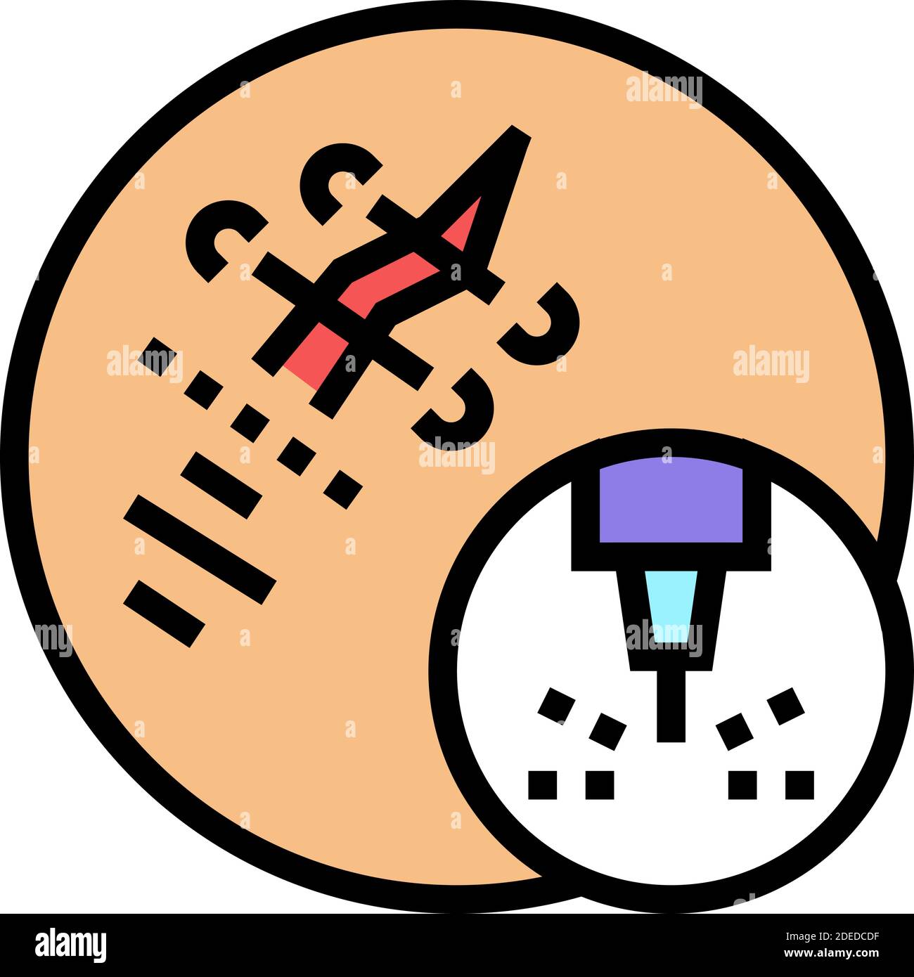 Removal vascular pathologies color hi-res stock photography and images ...