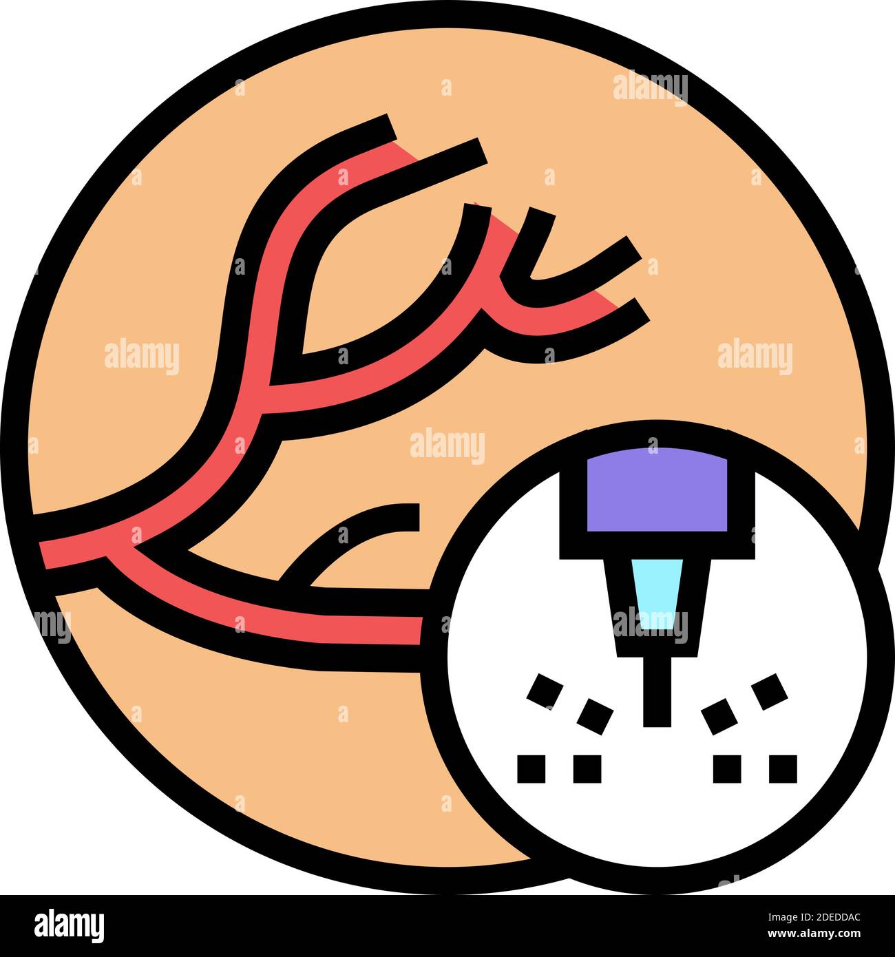 removal of vascular pathologies color icon vector illustration Stock ...